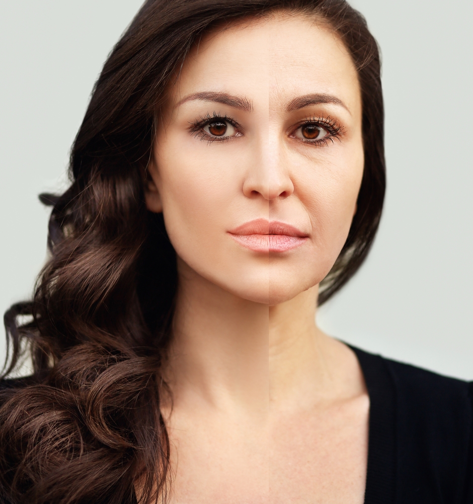 Botox in New Orleans - Lola's Medical Spa & Wellness